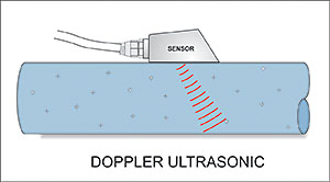 Doppler vs. Transit-time Ultrasonic Flowmeters: Which is right for you?